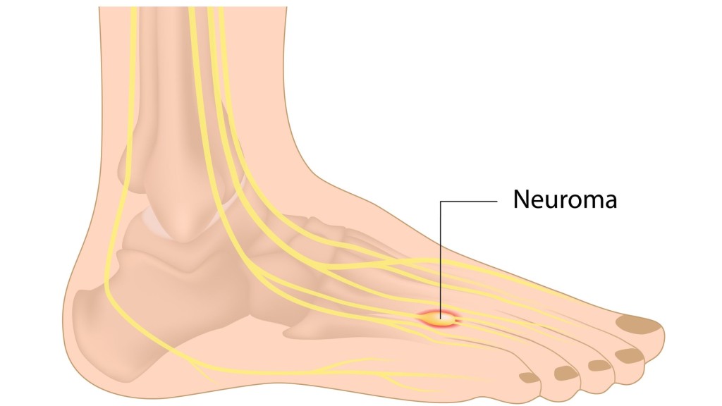 Southwest Foot & Ankle Center’s Dr. Reza Mobarak
